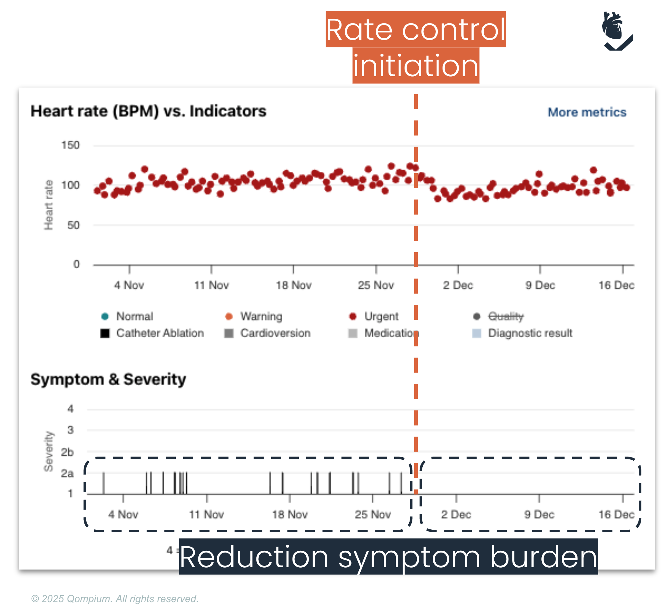 Rate control titration during AFib reduces symptom burden – FibriCheck ...