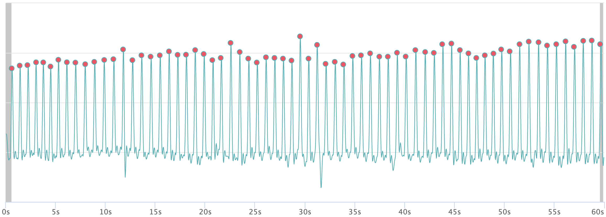 Chapter 3: Photoplethysmography (PPG), the new kid on the block ...