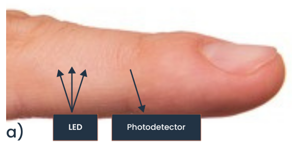 Chapter 3: Photoplethysmography (PPG), the new kid on the block ...
