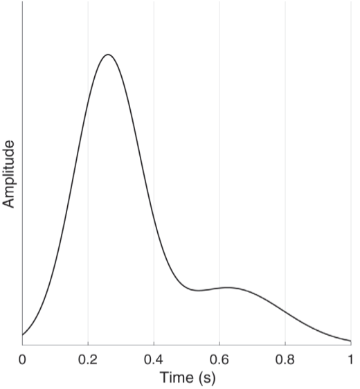 Chapter 7: Understanding and handling potential artifacts in PPG-signal ...