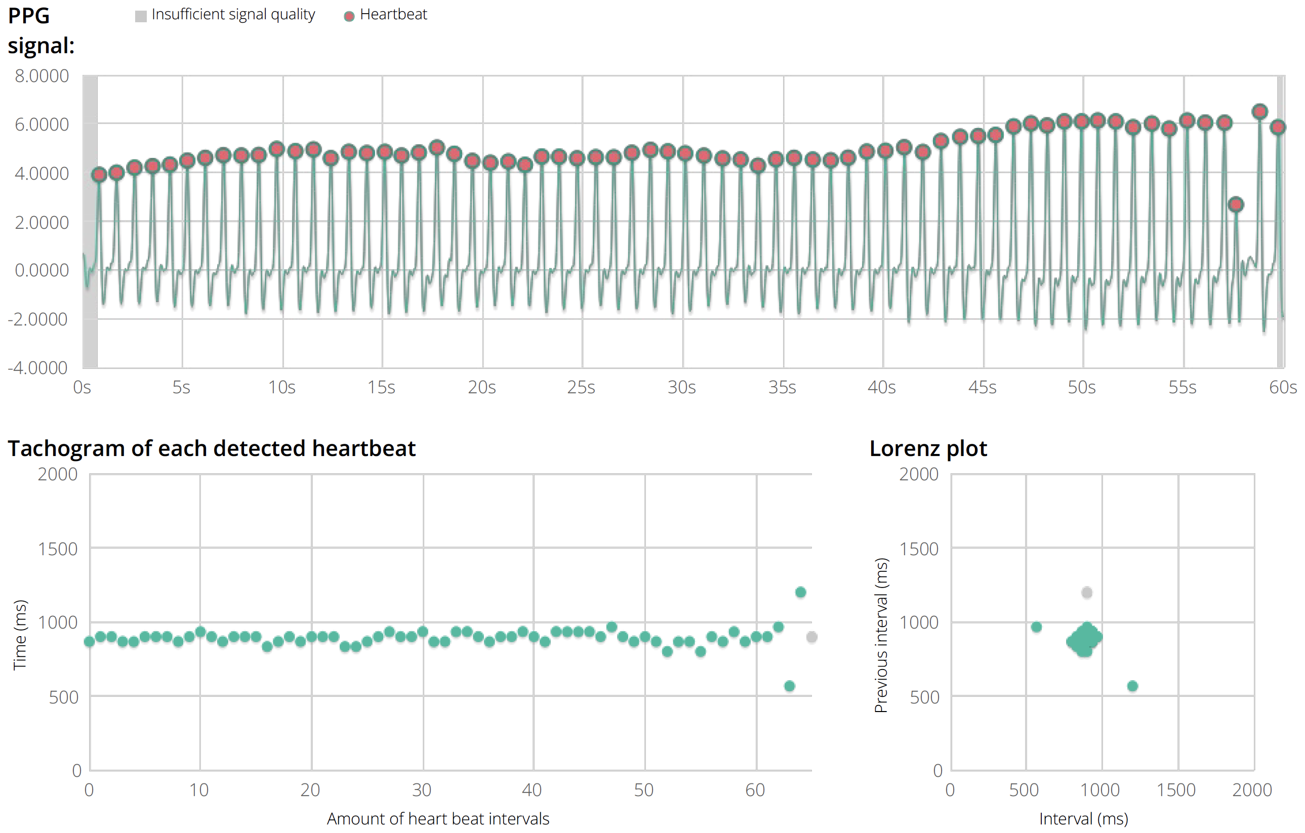Chapter 8: Differentiating regular and irregular PPG-recordings ...