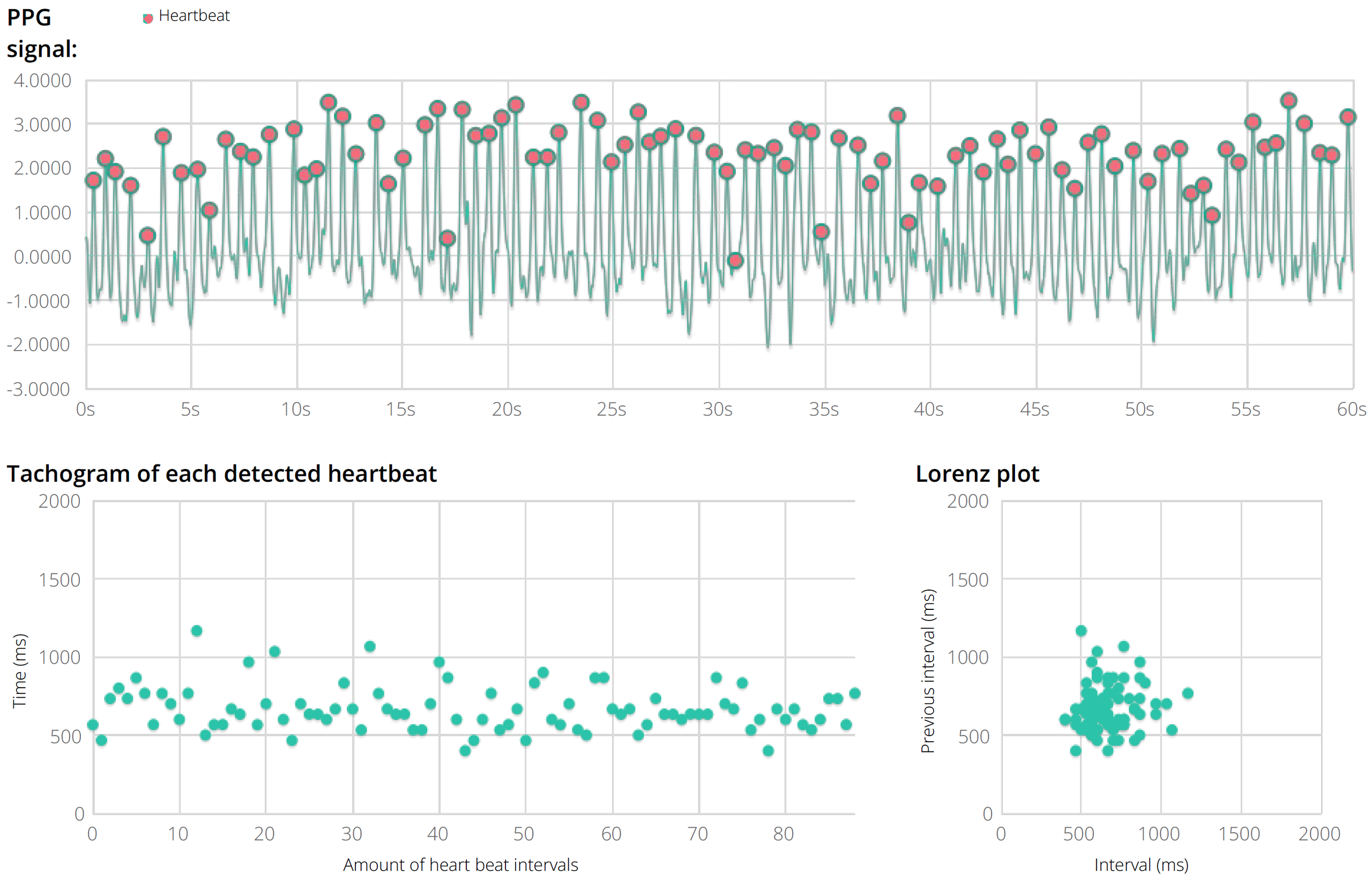 Chapter 8: Differentiating regular and irregular PPG-recordings ...